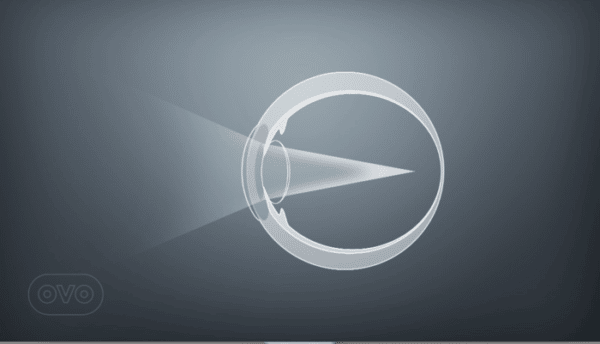 LASIK Eye Surgery | OVO LASIK + LENS, Minneapolis